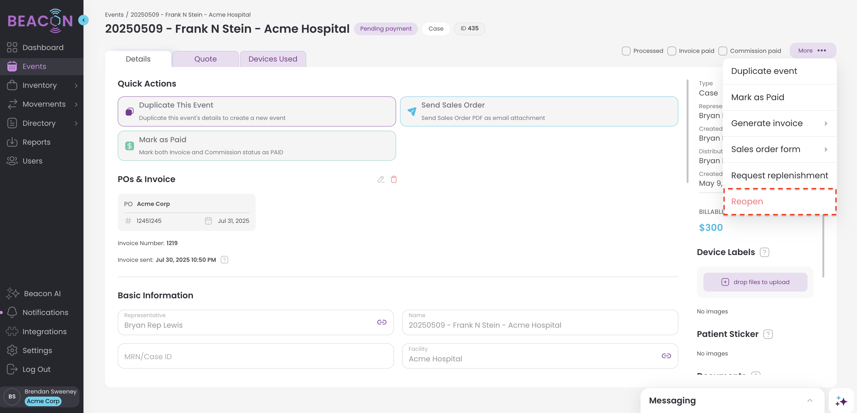 I made a mistake in a case, how can I fix it?